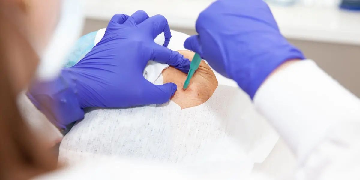 Trus Prostate Biopsy Testing Centre in Delhi - Edge Imaging